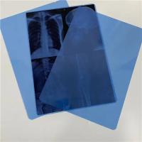 China Inkjet Printable PET Dry Laser X Ray Film Blue Base 14x17in for Diagnostic Imaging for sale