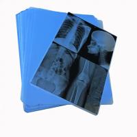 China Blue PET Based Thermal Inkjet X Ray Film 210mic for Medical Imaging Clinics Hospitals for sale