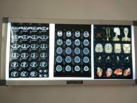 China Waterproof Medical X Ray Dry Film 8x10 10x12 14x17 inch for Laser Inkjet Printing for sale