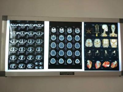 China Waterproof Medical X Ray Dry Film 8x10 10x12 14x17 inch for Laser Inkjet Printing for sale