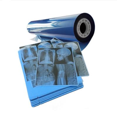 China Blue Medical Inkjet X Ray Film 210 Micron 9600x2400dpi for Canon Epson Printers for sale
