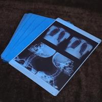 China Blue Inkjet Medical X-Ray Film 35x43 cm for Epson CT DR MR Imaging 175 Micron Base for sale