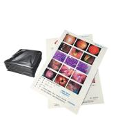 China Inkjet X Ray Film 14x17 Inches 9600x2400dpi High Resolution Medical Imaging Film for sale