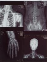China Medical X Ray Film FUJI DIHT 14x17in Laser Dry Imaging Film 100 Sheets per Box for sale