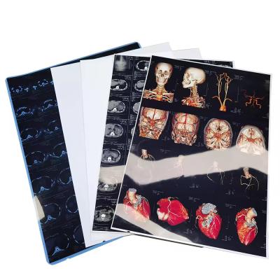 China Inkjet X Ray Film 9600x2400dpi for Canon Epson Printers Medical Imaging 8x10 14x17 for sale