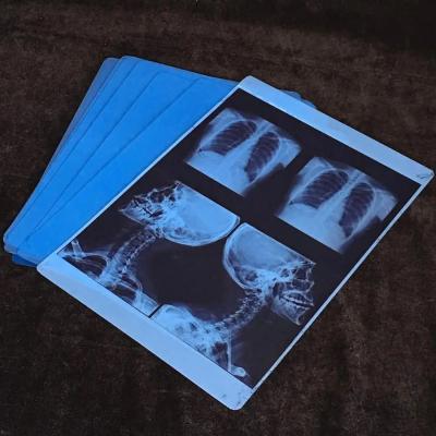 China 8x10 Inch Blue PET Inkjet X Ray Film 100 Sheets Pack 10 Packs Box for Medical Imaging for sale