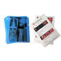 China Inkjet X Ray Film 210 Microns Blue for Canon Epson Printers Medical Imaging for sale