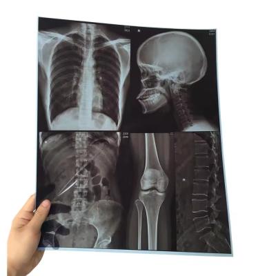 China Fuji DIHL Medical Dry Laser Imaging X Ray Film 8x10 10x12 11x14 Thermal for sale