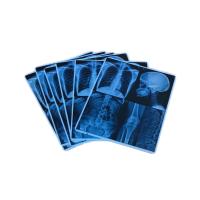 China Blue Medical Inkjet X Ray Film 210 Microns High Image Stability for Canon Epson Printers for sale