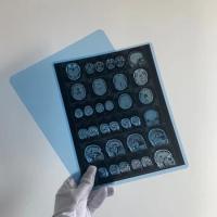 China Medical X Ray Inkjet Film 210 Microns Blue Clear Image for Canon Epson Printers for sale