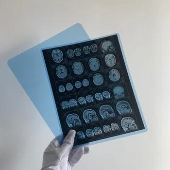 China Medical X Ray Inkjet Film 210 Microns Blue Clear Image for Canon Epson Printers for sale