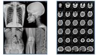 China Blue Inkjet Medical X Ray Film A4 Sheet 210 Micron for DR CT MRI Image Output for sale