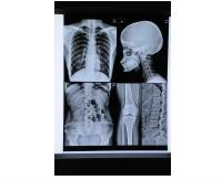 China Blue Inkjet Medical X Ray Film A4 Sheet 210 Micron for DR CT MRI Image Output for sale