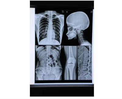 China Blue Inkjet Medical X Ray Film A4 Sheet 210 Micron for DR CT MRI Image Output for sale