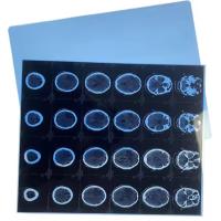 China Medical Blue Inkjet X Ray Film 10x12 inch 210 Micron for DR CT MRI Imaging for sale