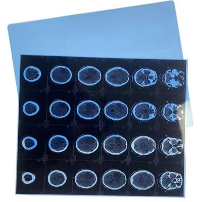 China Kefu Zhengao Inkjet X Ray Film 210 Microns Blue Medical Film for Canon Epson Printers for sale