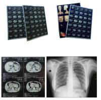 China A4 Blue Inkjet Medical Film 210 Micron PET for DR CT MRI Imaging for sale