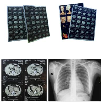 China A4 Blue Inkjet Medical Film 210 Micron PET for DR CT MRI Imaging for sale
