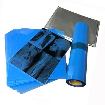 China Medical Blue Inkjet X Ray Film 10x12 inch 210 Micron for DR CT MRI Imaging for sale