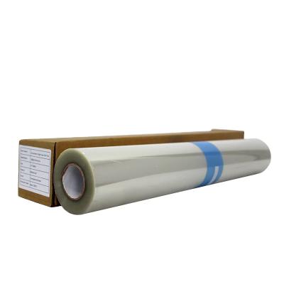 China Custom Blue Transparent PET Heat Transfer Film for Medical Imaging - 3.5 Max Density, Multiple Sizes 8x10 to 14x17 for sale
