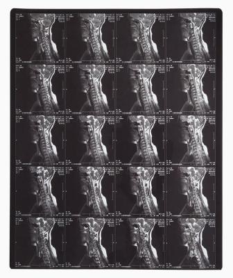 China Blue Radiological Imaging Laser Film For Thermal Print Laser Image Printer for sale