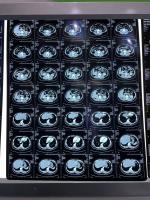 China Blue Laser X Ray Thermal Print Film 8x10 to 14x17 Max Density 3.0D for CT MRI for sale