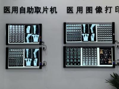 China Kefu PTF HJF Laser X Ray Film 14x17 inch Blue 0.28D Min Density for Medical Imaging for sale