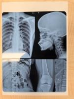 China Automatic Density Adjustment Laser X Ray Film For Medical Imaging for sale