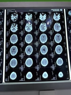 China Kefu PTF HJF Laser X Ray Film 3.0D Max Density Blue Medical Imaging Film 8x10 to 14x17 Sizes for sale