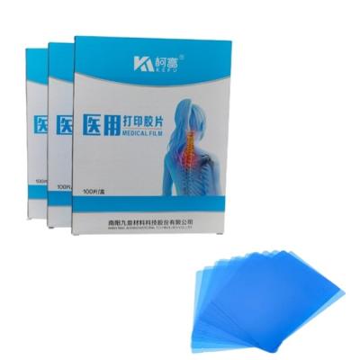 China Medical Image CT DR Inkjet Blue Film A4 PET X-Ray Film for Diagnostic Imaging for sale