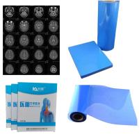 China High Sharpness PET X-ray Film 200μm for Medical Imaging 8x10 to 14x17 for sale