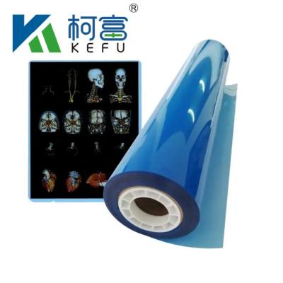 China Medical X Ray Film Blue Sensitive 175 Micron PET Base for CT MR Imaging for sale