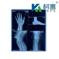 China Medical X Ray Film Blue Sensitive 175 Micron PET Base for CT MR Imaging for sale
