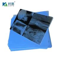 China Medical Blue PET Laser X Ray Film 8x10 to 14x17 Thermal Print ISO 13485 CE for sale