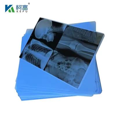 China Medical Blue PET Laser X Ray Film 8x10 to 14x17 Thermal Print ISO 13485 CE for sale