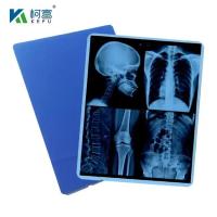 China Medical Blue Laser X Ray Film 8x10 to 14x17 for Thermal Print Process CT Imaging for sale