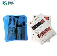China Laser X Ray Film Blue 14x17 Inch Thermal Print Medical Imaging for CT Scanner for sale