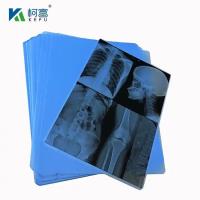 China Blue Laser X Ray Film 8x10 to 14x17 Thermal Print for Medical Imaging for sale
