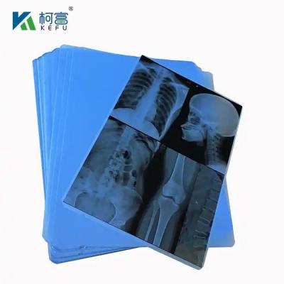 China Blue Laser X Ray Film 8x10 to 14x17 Thermal Print for Medical Imaging for sale