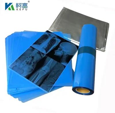 China Blue PET Laser X Ray Film 8x10 to 14x17 for Medical Imaging Thermal Print for sale