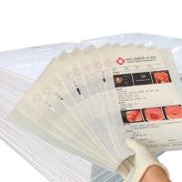 China Waterproof Digital Printing Film 135mic for Positive Printing Medical Laser Film for sale
