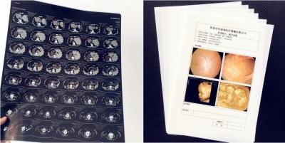 China Medical White Opaque Laser Print Film 125-180 Microns for Epson Canon Inkjet Printer for sale