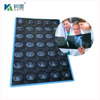 China High Resolution Medical X Ray Film 14x17 inch 150 Sheets per Box for Accurate Diagnosis for sale