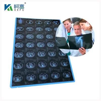 China High Resolution Medical X Ray Film 14x17 inch 150 Sheets per Box for Accurate Diagnosis for sale