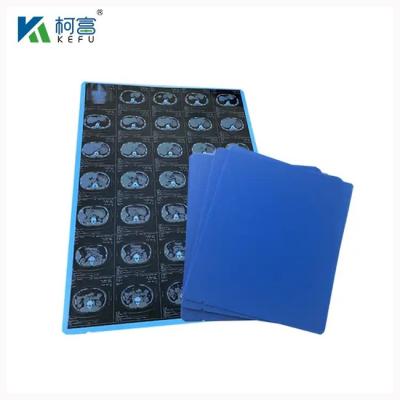 China Radiology PET Dry Inkjet Medical Blue Film 8x10 10x12 14x17 Inch for X Ray CT MRI for sale
