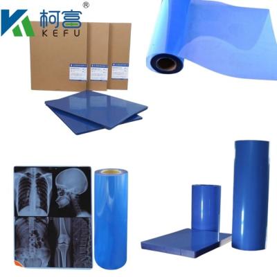 China KEFU Blue Medical X-ray Film 14x17 Inch Round Corners Notch for Digital Imaging for sale