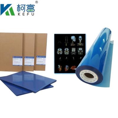 China Customized Size 35x43 Inkjet Blue Medical X Ray Film for Epson A4 PET Dry Blue Medical Laser Xray for sale