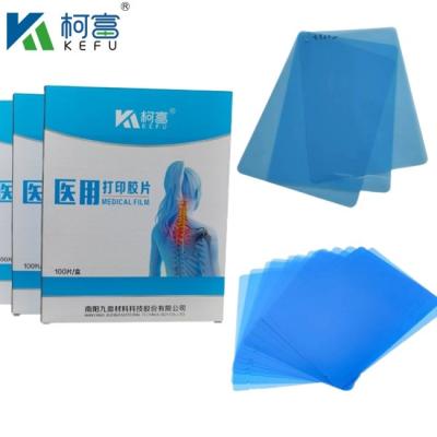 China Customized Inkjet Blue Medical X Ray Film for Epson A4 A3 PET Dry Blue 210 Microns for sale