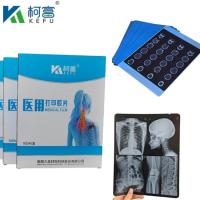 China Custom Blue PET Medical X Ray Inkjet Film 210 Micron for Clinic Hospital Imaging for sale