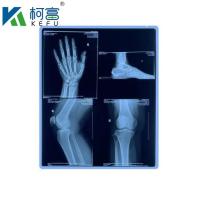 China Custom Blue PET Medical X Ray Inkjet Film 210 Micron for Clinic Hospital Imaging for sale